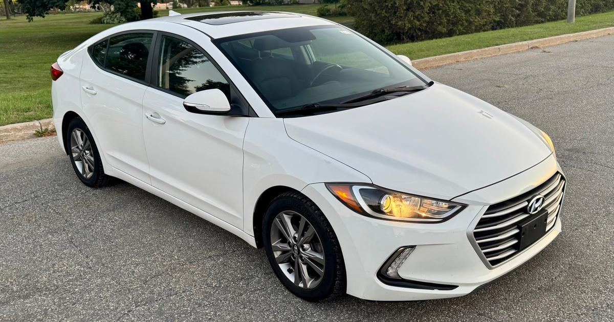 Hyundai Elantra 2018 rental in Ottawa, ON by Turo C. | Turo